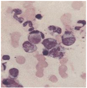 Exame de CÉLULAS LE em São Paulo - Laboratório Biolider